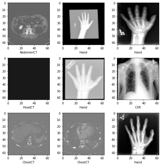 Monai_mednist_tutorial | Extreme Tools for Science and Engineering ... Monai_mednist_tutorial | Extreme Tools for Science and Engineering ...